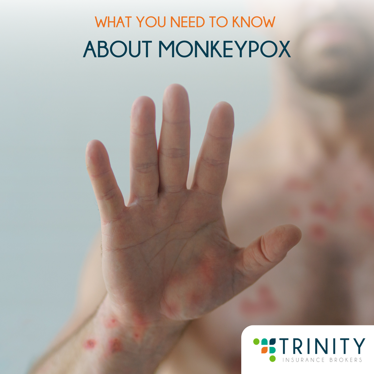 What You Need to Know about Monkeypox – Trinity Insurance and ...